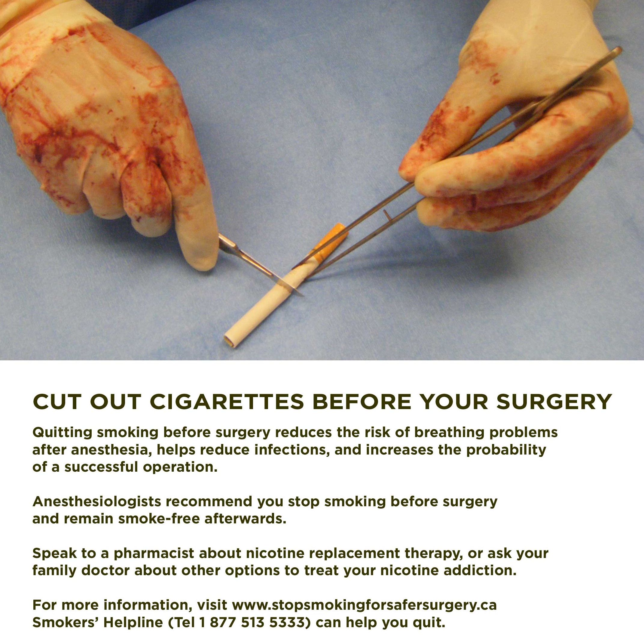Stop Smoking For Safer Surgery